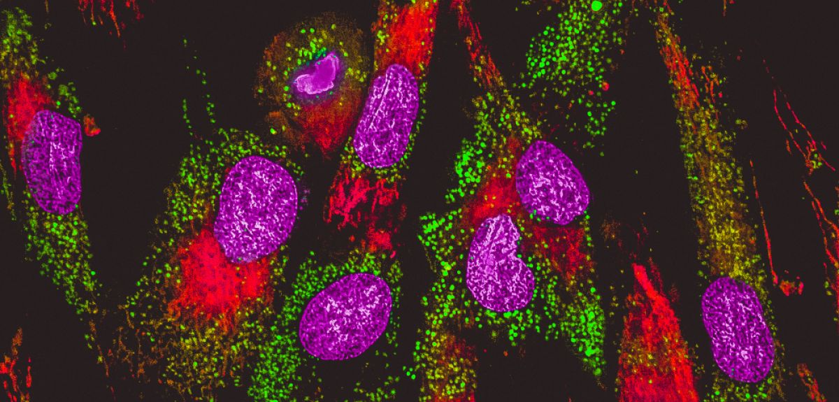 Trial investigating potential treatment for fatigue relief in people with long COVID reports ...